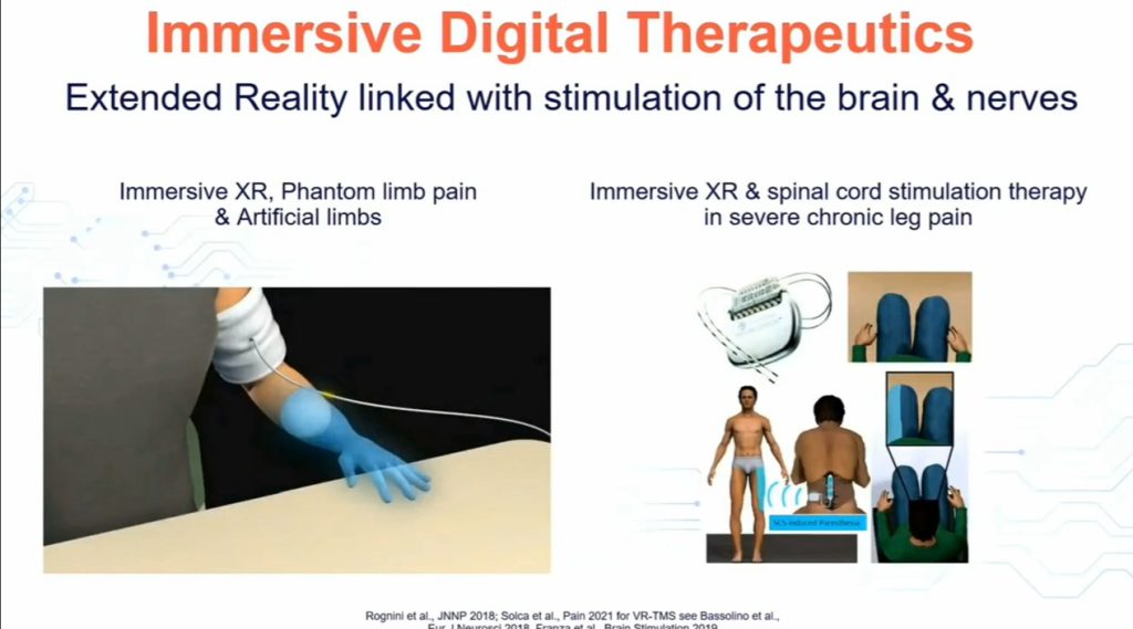 CERN - Human Augmentation, Full Immersion AR/VR/MR = Extended Reality ...